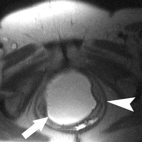Mr Imaging Of The Female Urethra And Supporting Ligaments In Assessment