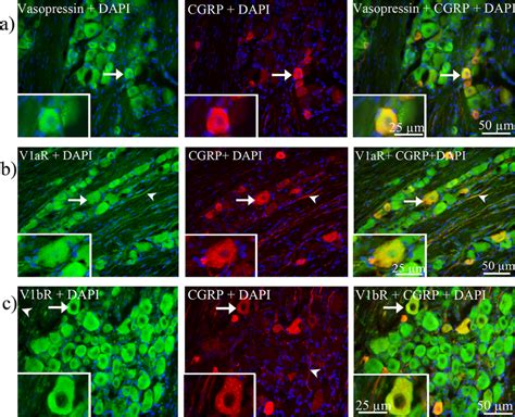 Co Localization Of Vasopressin And Its Receptors With Cgrp In Tg A