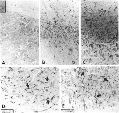 Glial [13 Amyloid Precursor Protein] App Expression In Hippocampus