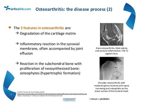 The Pathophysiology Of Osteoarthritis