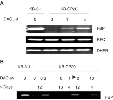 Reverse Transcriptase Pcr Analysis On Gene Expression A Fbp Rfc