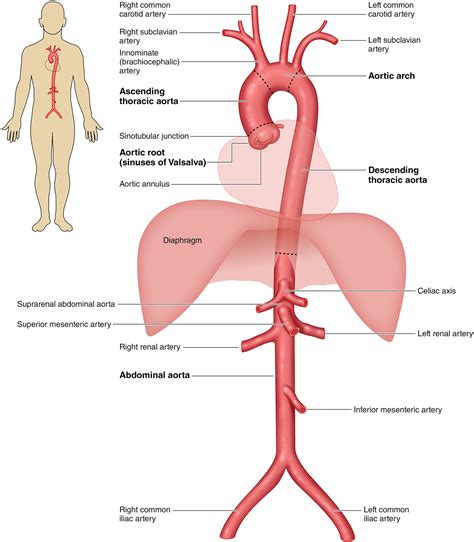 2022 Acc Aha Guideline For The Diagnosis And Management Of Aortic