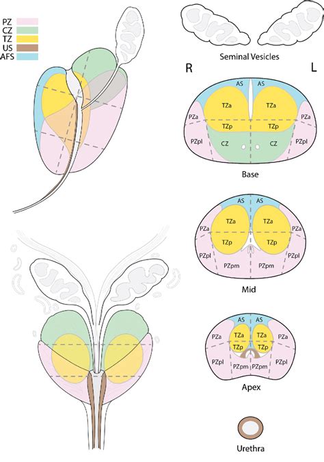 Figure 3 From Synopsis Of The Pi Rads V2 Guidelines For Multiparametric