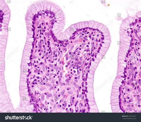 Simple Columnar Epithelium Uterine Cervix EpitheliumẢnh Có Sẵn295184477