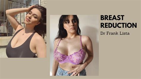 My Breast Reduction Story Qanda 40i 34ddd Youtube