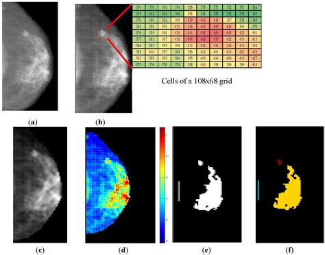 algorithms free full text mammographic segmentation using wavecluster