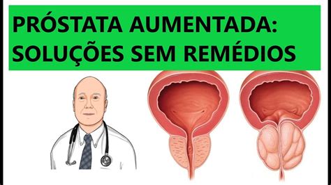Como Tratar Aumento Da Próstata Sem Remédios Dicas Para Lidar Com A