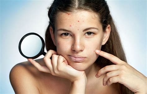 Hướng Dẫn Cách điều Trị Mụn Nội Tiết Khi Mang Thai