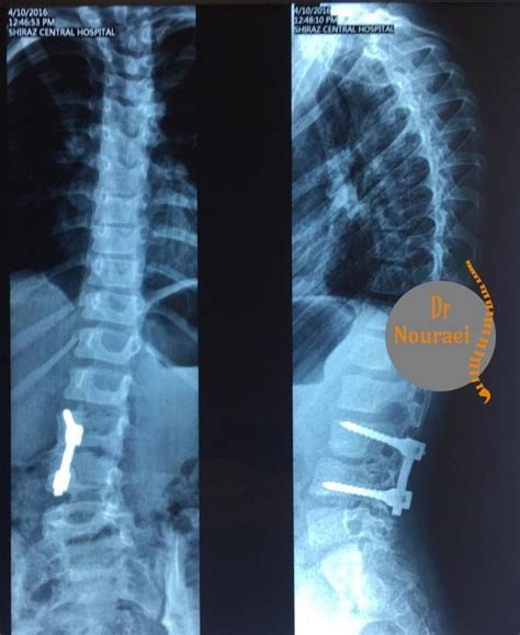 Congenital Deformity Dr Nouraei