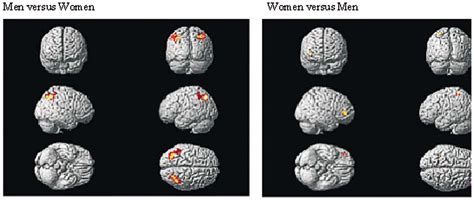 Figure 1 From Sex Differences In Brain Activation Pattern During A