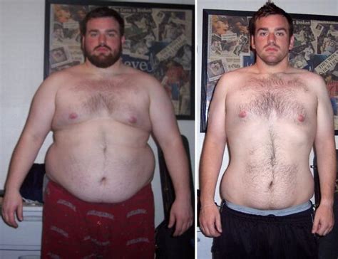 Weight Loss Success Story 48 Pics Video