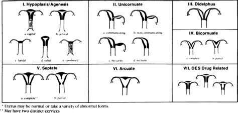 Classification System For Müllerian Anomalies Developed By The American