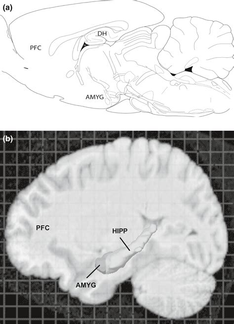 The Neurobiological Basis Of Sex Differences In Learned Fear And Its
