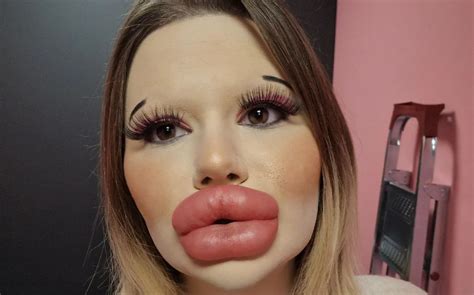 Deze Influencer 25 Heeft De Grootste Lippen Ter Wereld Nu Is Ze Toe