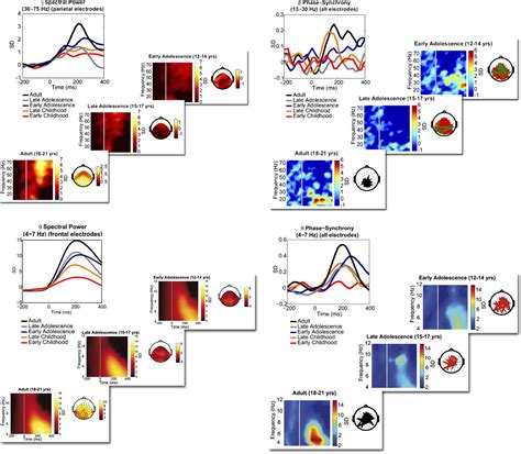 Figure 1 From The Development Of Neural Synchrony And Large Scale