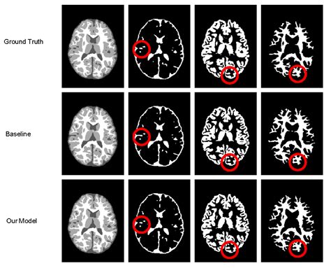 non local u net for biomedical image segmentation papers with code