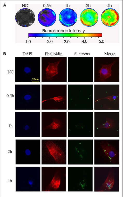 Figure 1 From Microbicidal Phagocytosis Of Nucleus Pulposus Cells