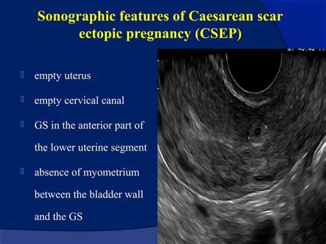 Early Pregnancy Ultrasonographic Evaluation