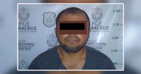 Lo Vinculan A Proceso Por Lesiones Dolosas Calificadas
