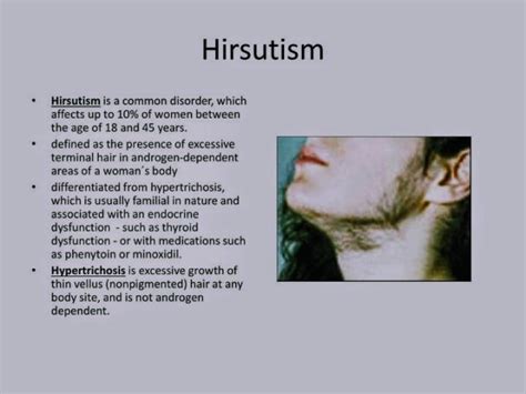 What Is Hirsutism Pt Master Guide