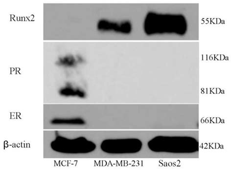 Positive Association Between Nuclear Runx2 And Oestrogen Progesterone