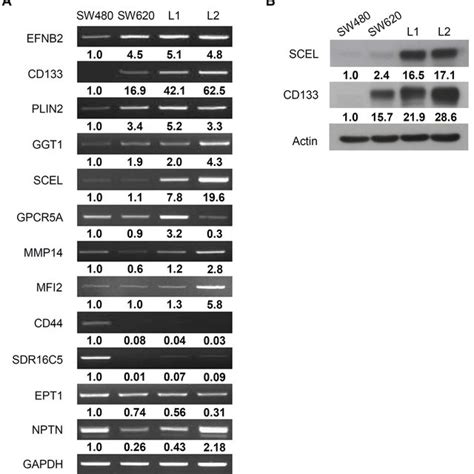 Validation Of Proteomic Result A Rt Pcr Assay For The Proteins