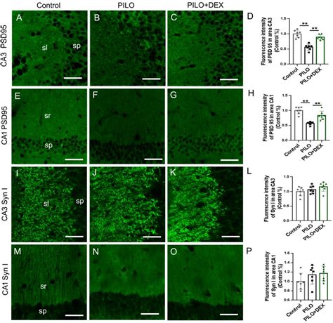 Figure 5 From Effects Of Dexamethasone On Remodeling Of The Hippocampal