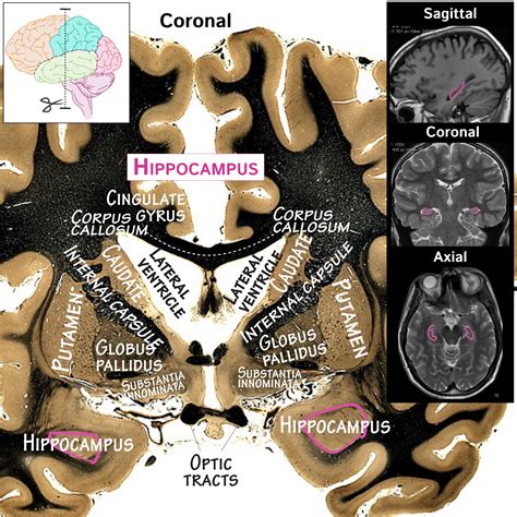 Neuroanatomy Glossary Hippocampus Ditki Medical And Biological Sciences