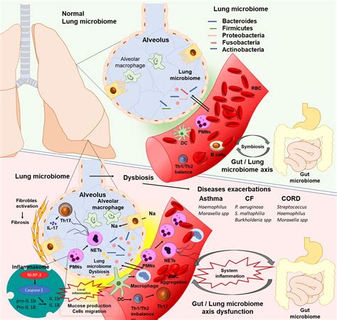 The Lung Microbiome Immunity And The Pathogenesis Of