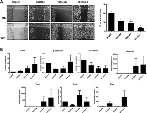Cell Migration And Emt Gene Expression Of Hccs A The Cell Migration