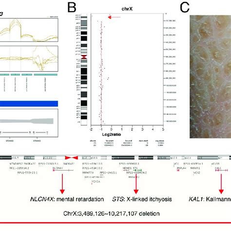 Diagnostic Rate Of Targeted Next Generation Sequencing Ngs In
