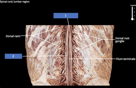Cadaver Spinal Cord For Identification In Lab Flashcards Quizlet