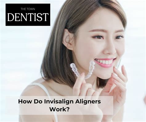 How Do Invisalign Aligners Work