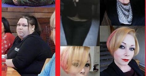 After Weightloss Surgery Tijuana Mexico 10 03 2016 Album On Imgur