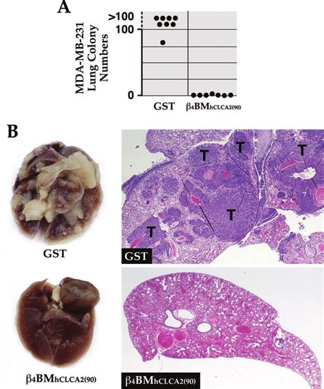 Inhibition Of Lung Colonization By 4 Bm Hclca2 90 A Mda Mb231 Breast