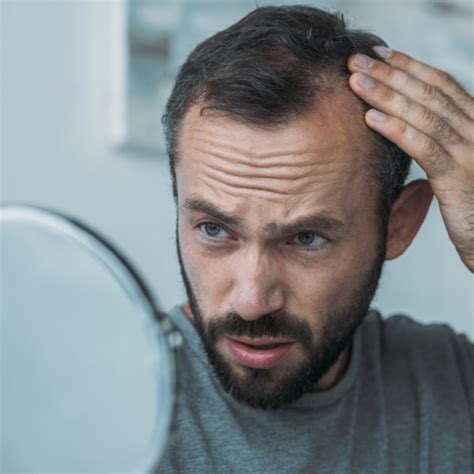 Understanding Hair Loss Options Forefront Dermatology