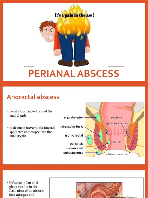Perianal Abscess Pdf
