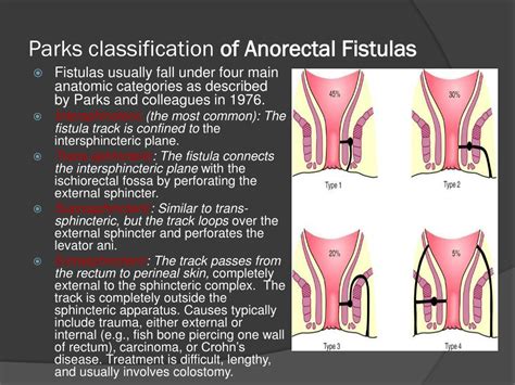 Ppt The Anus And Rectum Powerpoint Presentation Free Download Id
