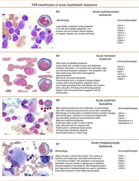 Fab Classification Of Leukemia Dentowesome Leukemia Hematology
