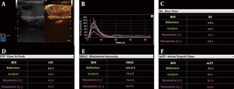 Value Of Quantitative Contrast Enhanced Ultrasonography In