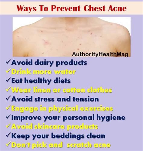 How To Get Rid Of Chest Acne Fast