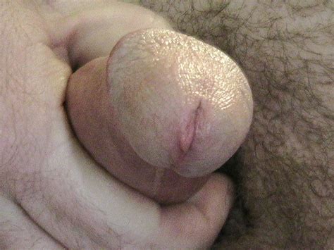 circumcised penis cock head closeup 47 pics xhamster