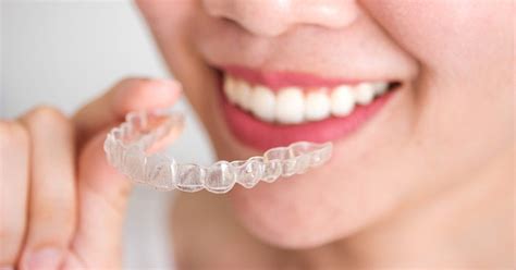 The Invisalign Results Timeline Insights From An Orthodontist