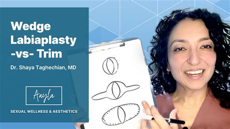 Wedge Labiaplasty Vs Trim Labiaplasty Youtube