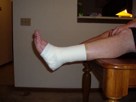 How To Tape An Ankle 8 Steps Instructables