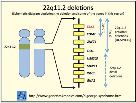22q11 2 Deletion Syndrome Checkrare