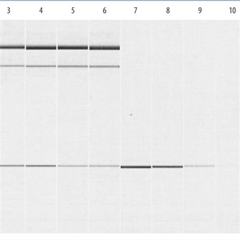 Multiplex Polymerase Chain Reaction Results Of A Group Of 6 Whey