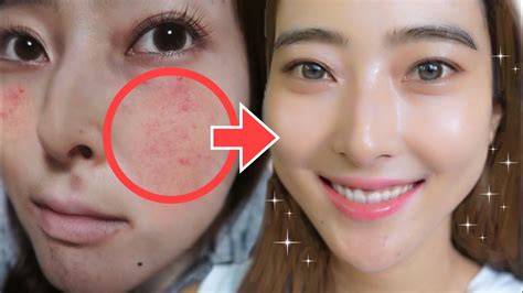 Japanese Skincare Routine For Glowing Glass Skin💧morning And Night For