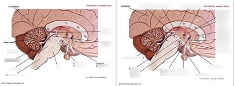 Forebrain Medial View Diagram Quizlet