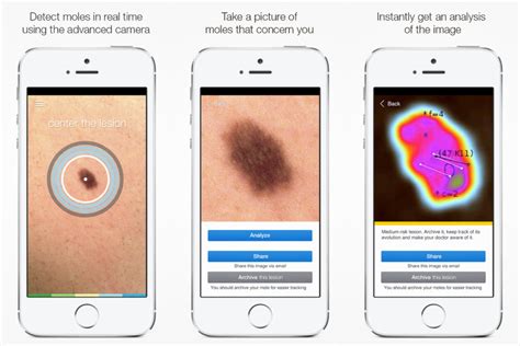 Computer Vision Techniques For The Diagnosis Of Skin